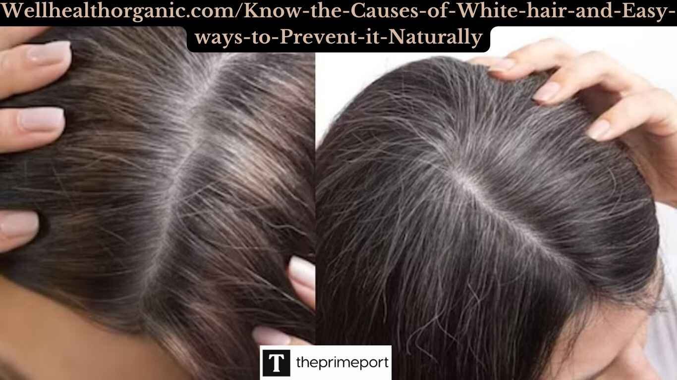 Wellhealthorganic.com/Know-the-Causes-of-White-hair-and-Easy-ways-to ...